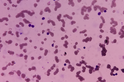 Tout ce que vous devez savoir sur l'indice d'anisocytose